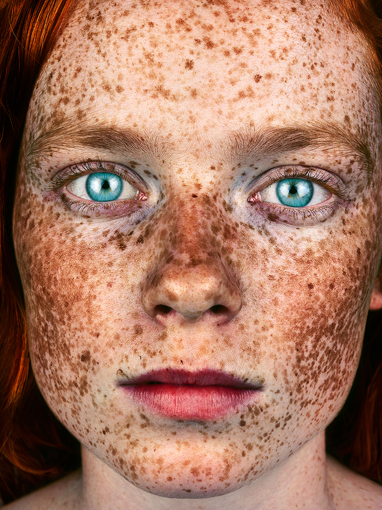 BROCK ELBANK SHOOTS FOLLOW-UP PORTRAIT OF FACE BEHIND THE FRECKLES ...